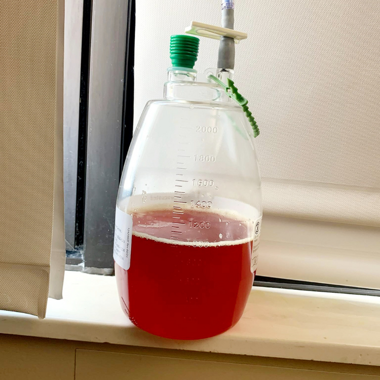 Liter of Fluid Drained from Richie's Lung Today – Every Step Is A ...